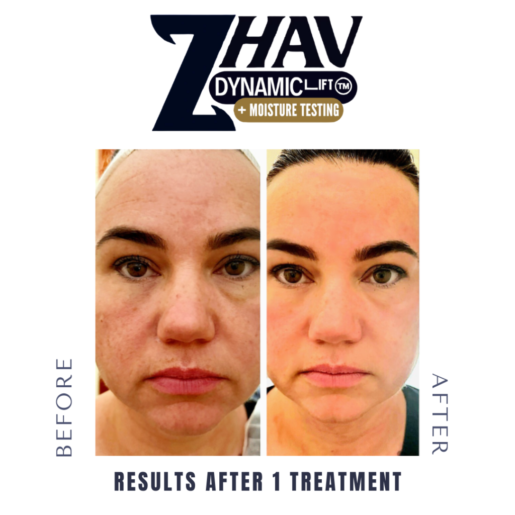 ZHAV DYNAMIC LIFT TM + MOISTURE TESTING- Hands-Free Machine